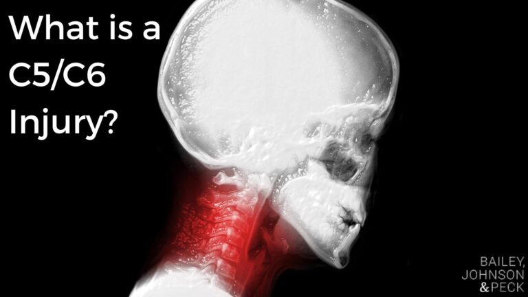 What is a C5/C6 Injury? | Bailey, Johnson & Peck, P.C.